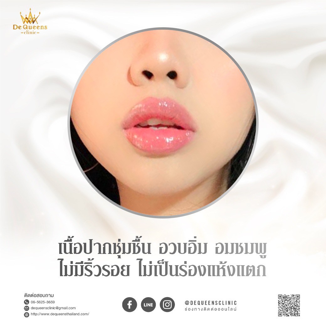 3 เทคนิคเติมเต็มริมฝีปากแบบ 4D Boosters KOREAN LIPS 4D เทคนิคเติมเต็ม Cell Booster ริมฝีปากสไตล์ ...