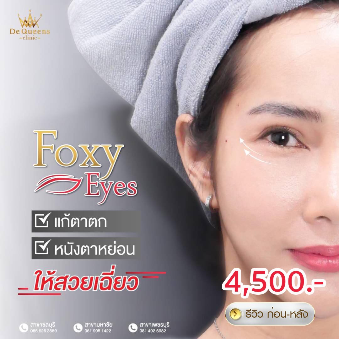 10 คำถามยอดฮิตเกี่ยวกับร้อยไหม Foxy Eyes