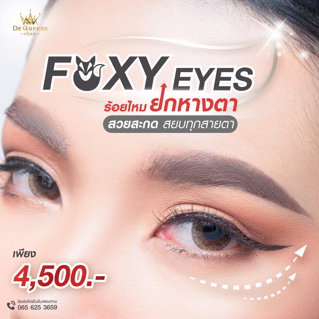 เทรนด์ Foxy Eyes 2024 เลือกคลินิกที่ใช่ ยังไงก็ปัง