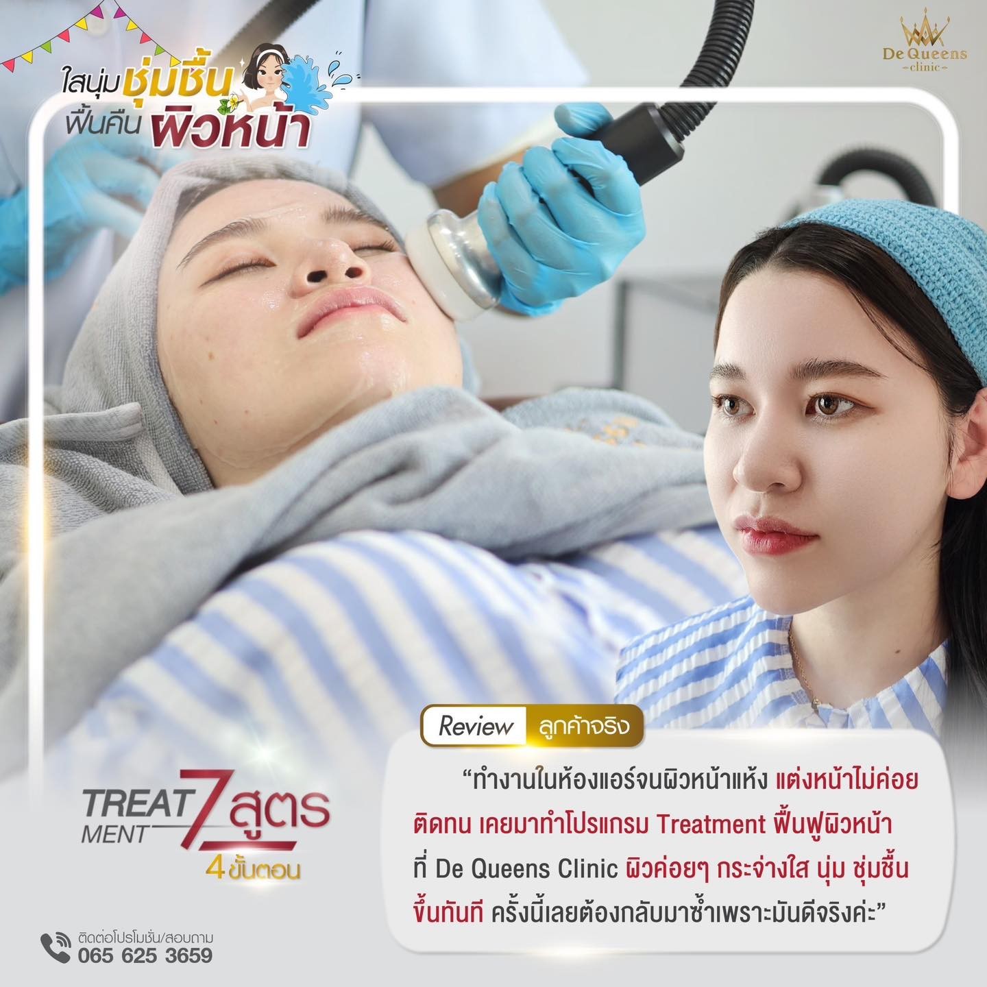 รีวิว Treatment