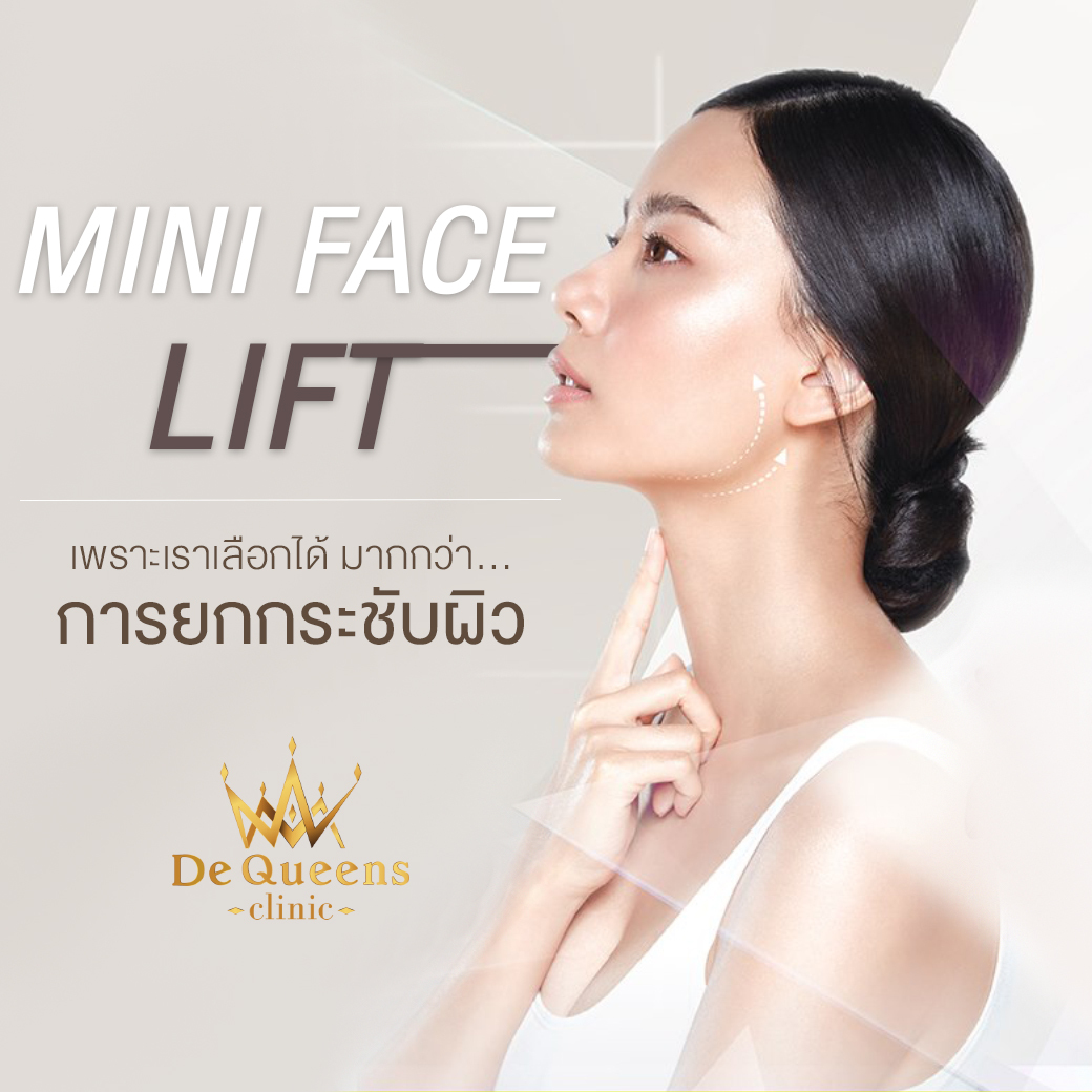 ร้อยไหมยกกระชับหน้า Mini Face Lift