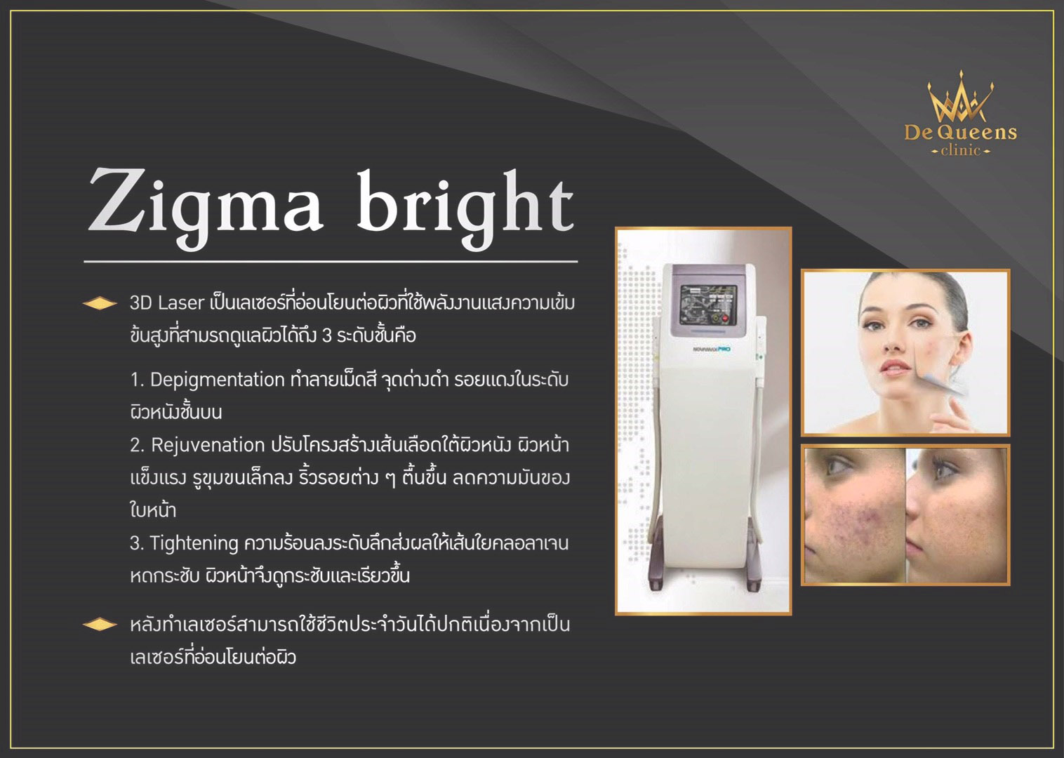 ฟื้นฟูหน้าใสด้วย Zigma bright (IPL)