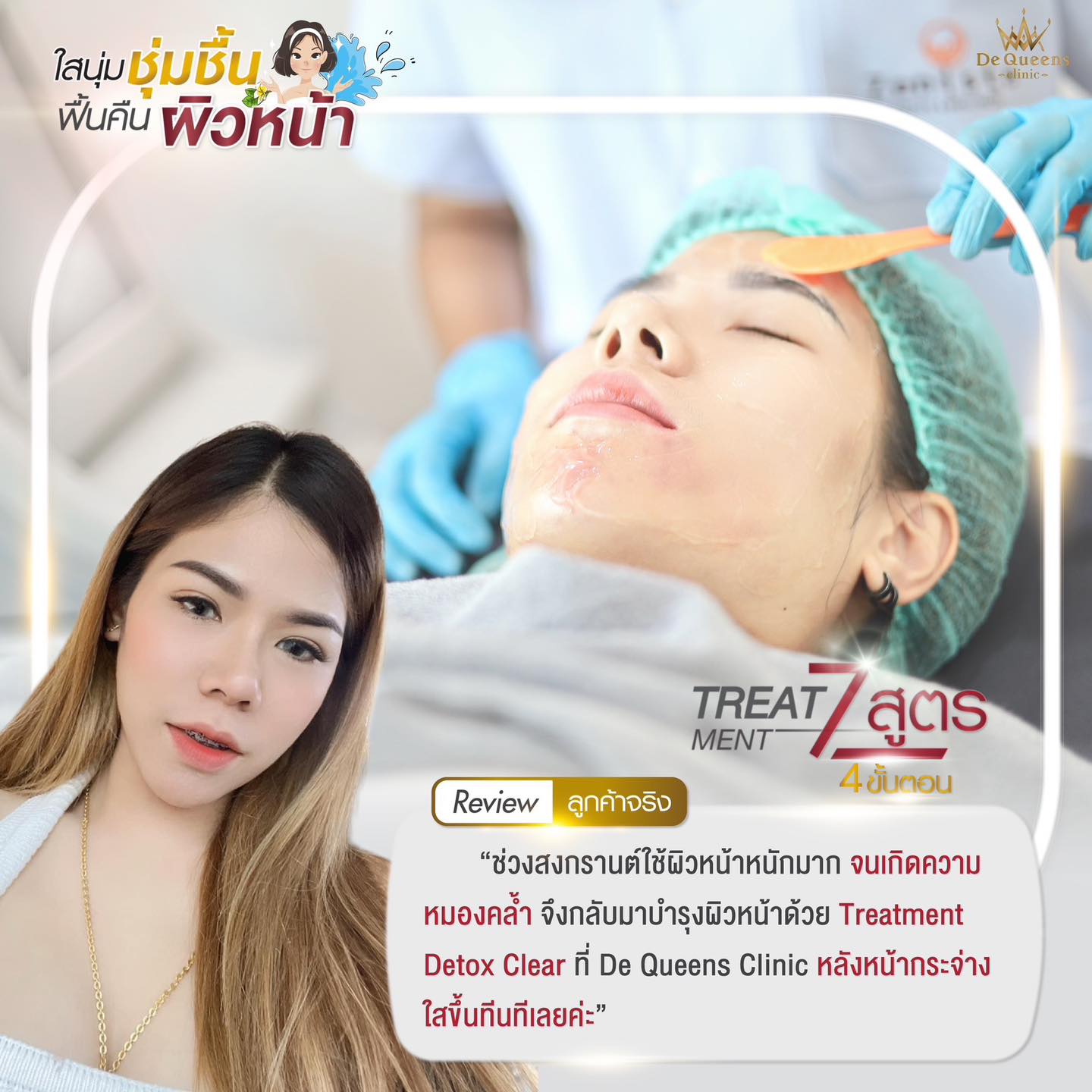 รีวิว Treatment